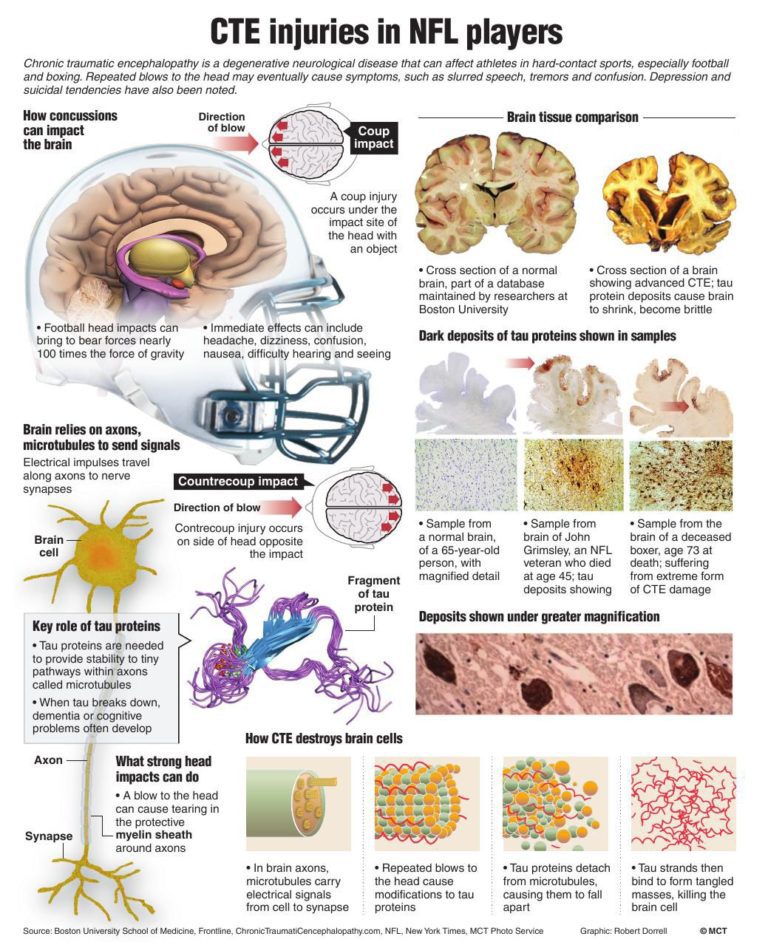 Concussion & CTE (Chronic Traumatic Encephalopathy) | FULL HEALTH SECRETS